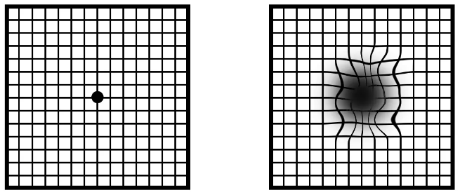 Edem makule - Sveti Vid