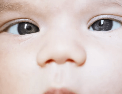 Katarakta - kako se javlja, koji su simptomi i sigurna rešenja? - Sveti Vid